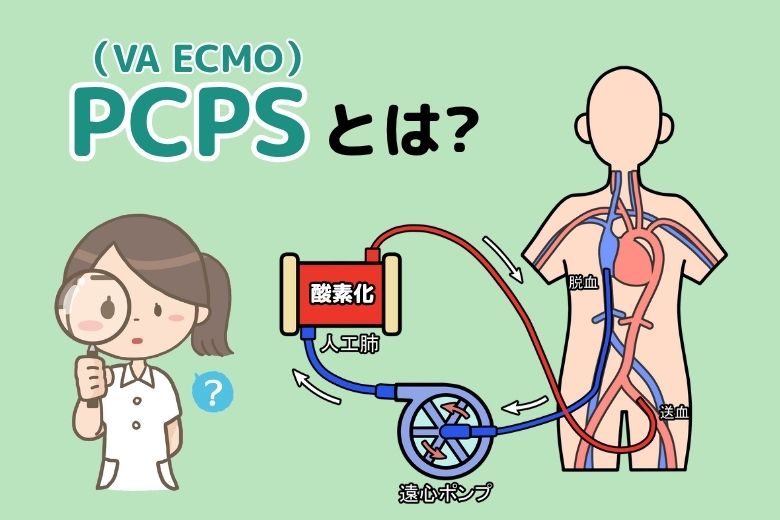 PCPS（VA ECMO）の何故？を解決！看護師が知りたい観察ポイントや注意点について | 障がいマナビサイト